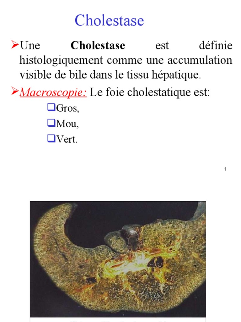 Cholestase | PDF | Organe | Biologie