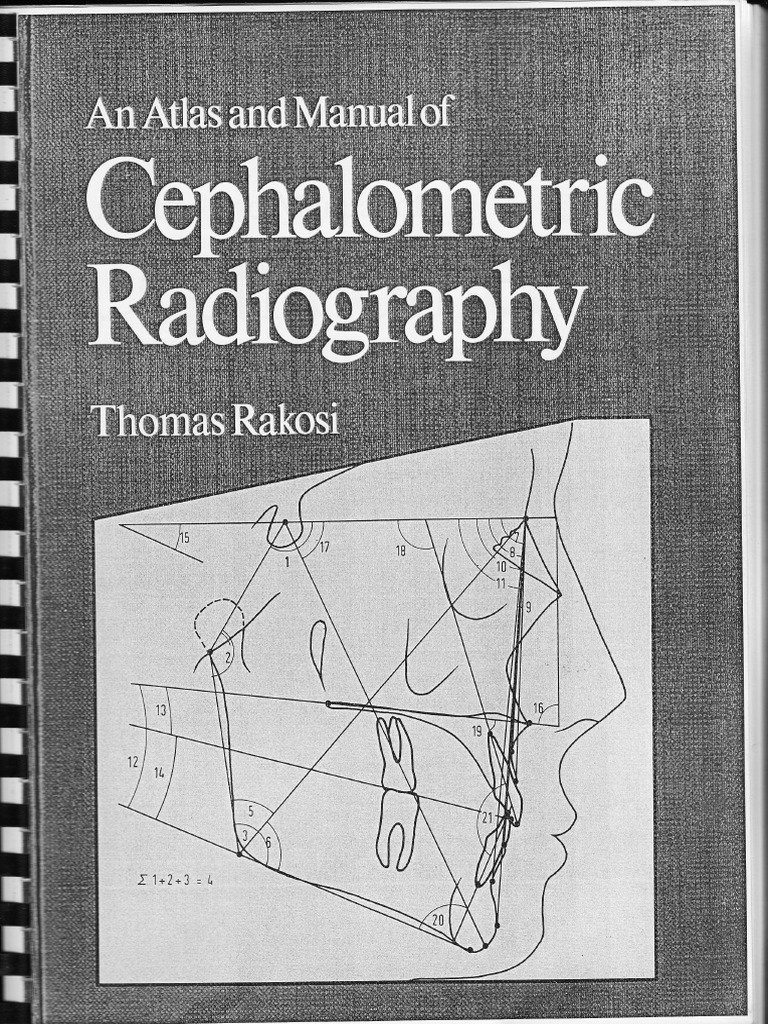 An Atlas and Manual of Cephalometric Radiography | PDF | Human Anatomy ...
