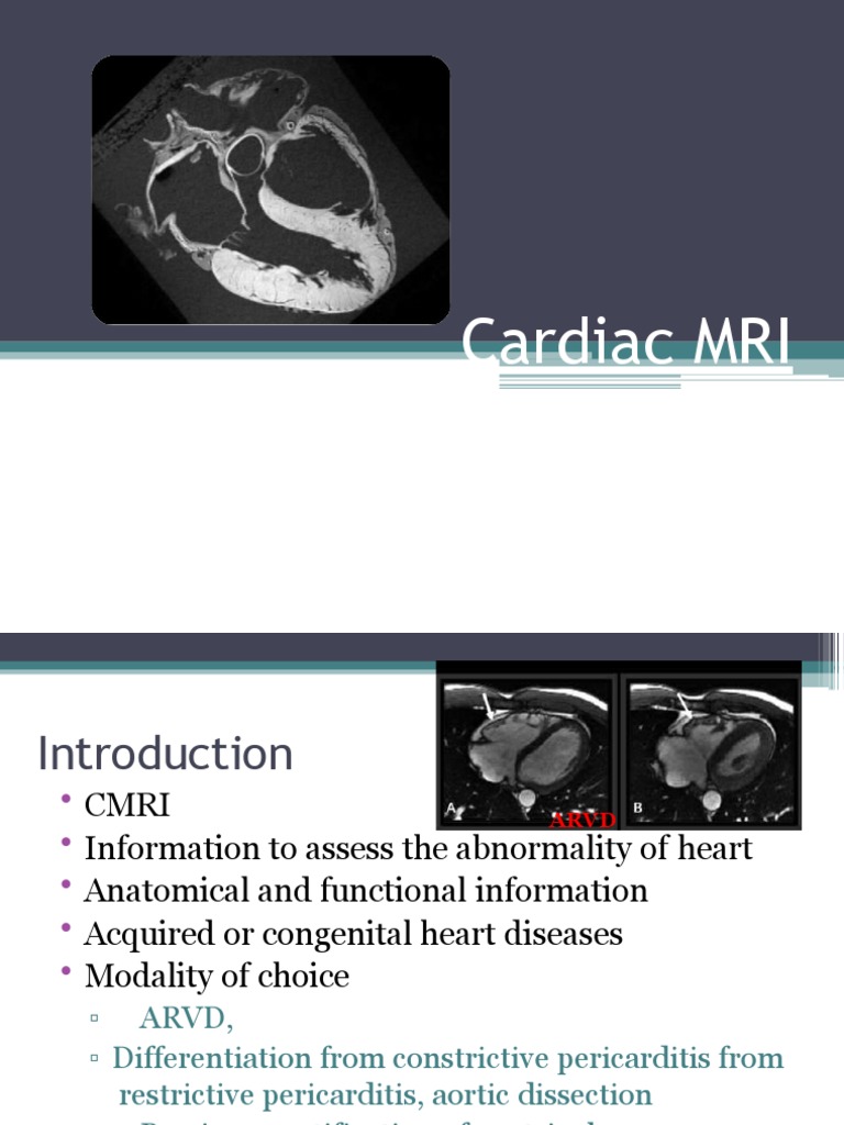 CMRI | PDF | Heart | Cardiac Muscle
