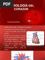 Interpretacion RX Torax Silueta Cardiaca V2 | PDF | Corazón | Pulmón