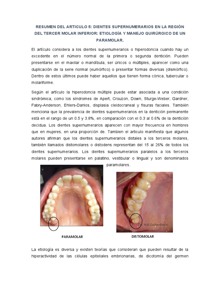 Resumen Del Articulo 5 Dientes Supernumerarios en La Región Del Tercer ...