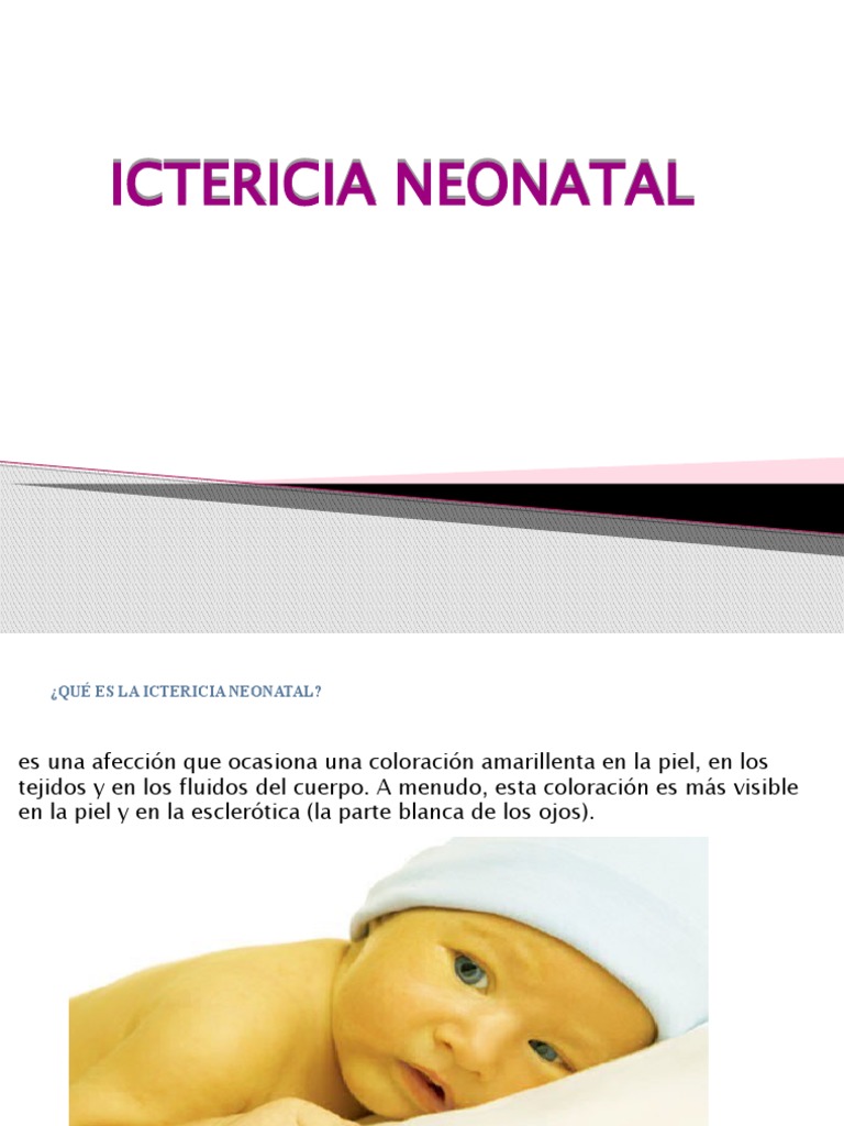 Ictericia Neonatal | Descargar gratis PDF | Especialidades Medicas | Medicina CLINICA