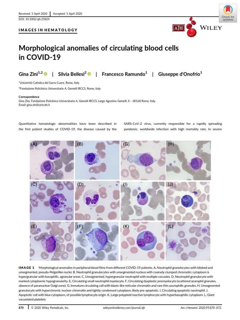 Morphological Anomalies of Circulating Blood Cells | PDF | Granulocyte ...
