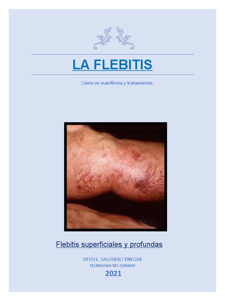 La Flebitis | PDF | Trombo | Terapia intravenosa