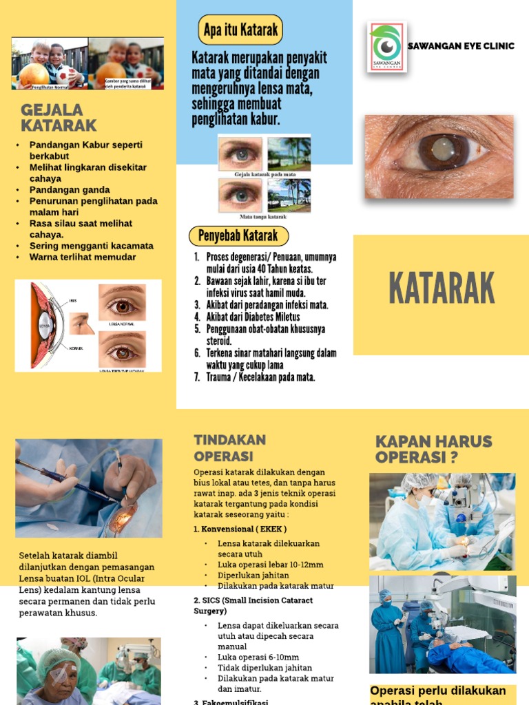 Leaflet Katarak | PDF