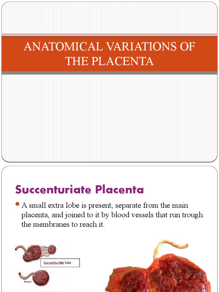 Anatomical Variations of Placenta | PDF