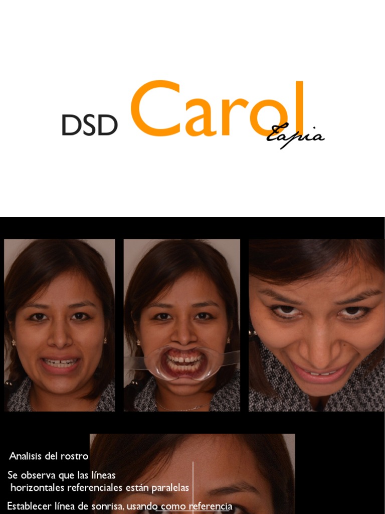 DSD Paso A Paso | PDF | Anatomia dental | Diente