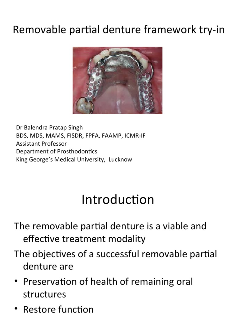 Removable Partial Denture Framework Try-In | PDF | Dentures | Dentistry ...