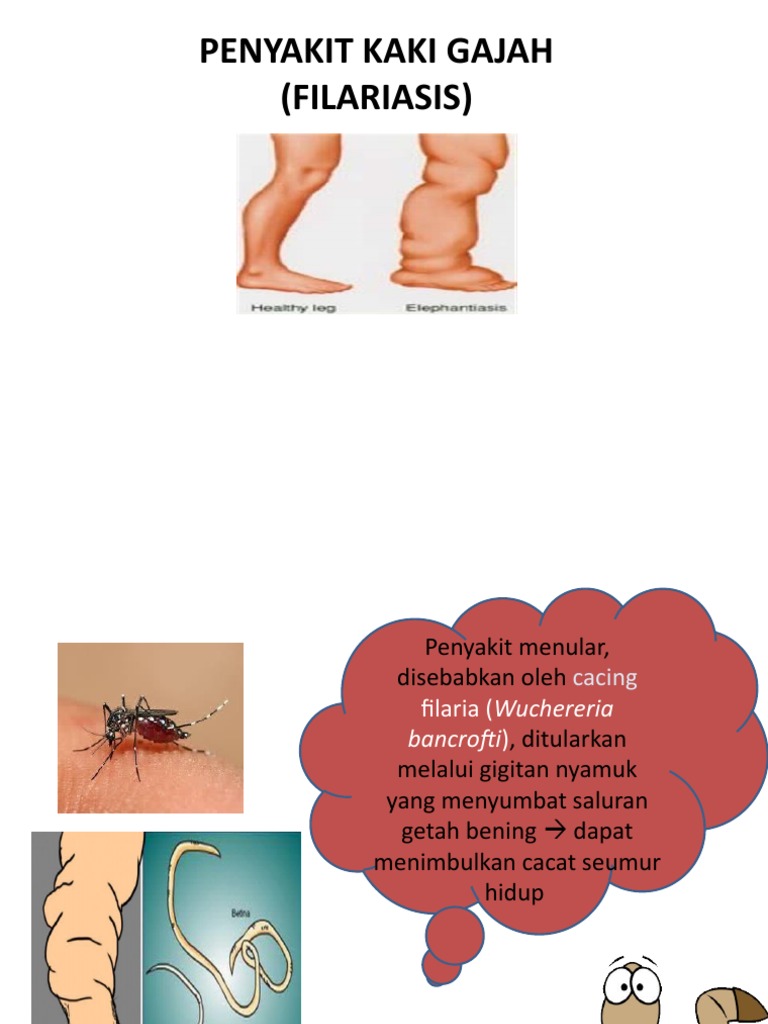 Filariasis | PDF