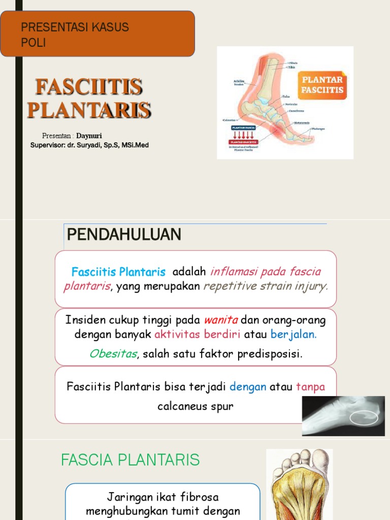 Plantar Fasitis Nuri Rev 3 | PDF