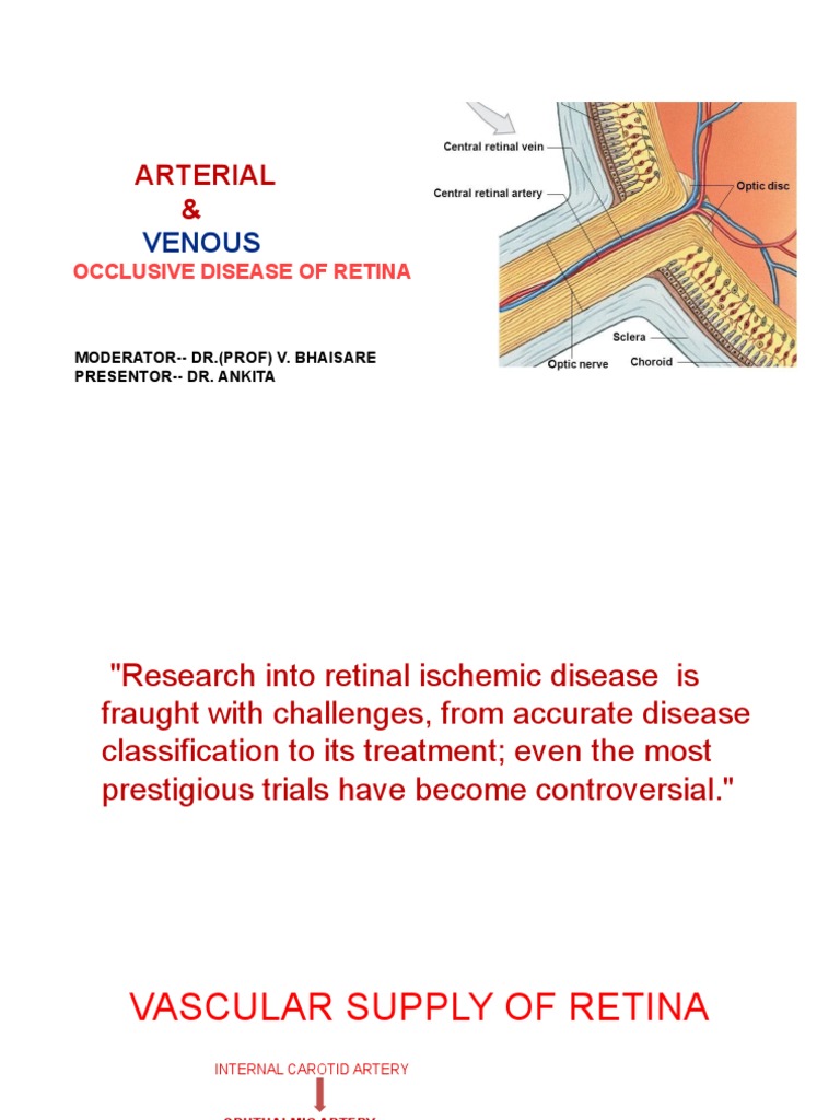 Crvo Crao | PDF | Retina | Embolism