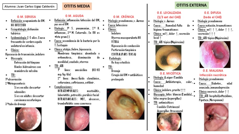Tipos y Tratamientos de Otitis Externa | PDF | Epidemiología | Microbiología