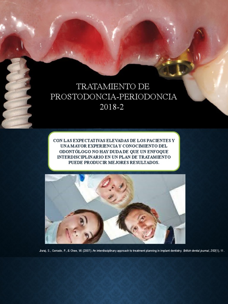 Relción Prosto Perio | PDF | Implante dental | Ramas de Odontología