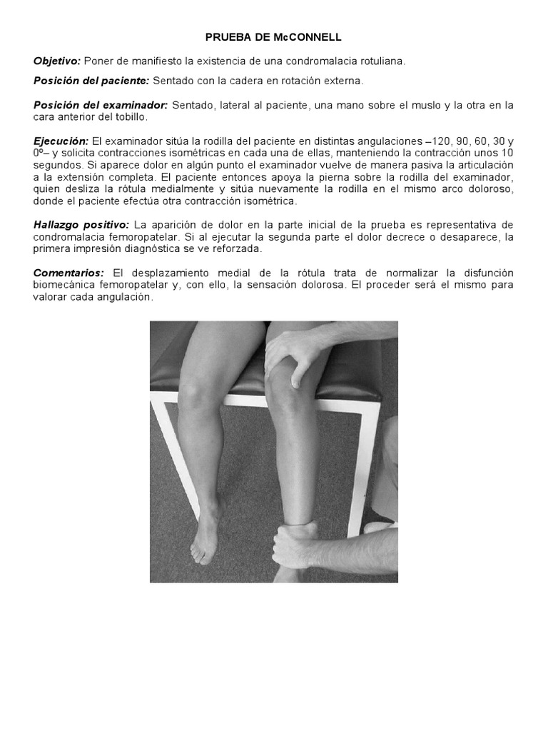 Prueba de McConnell para Condromalacia | PDF