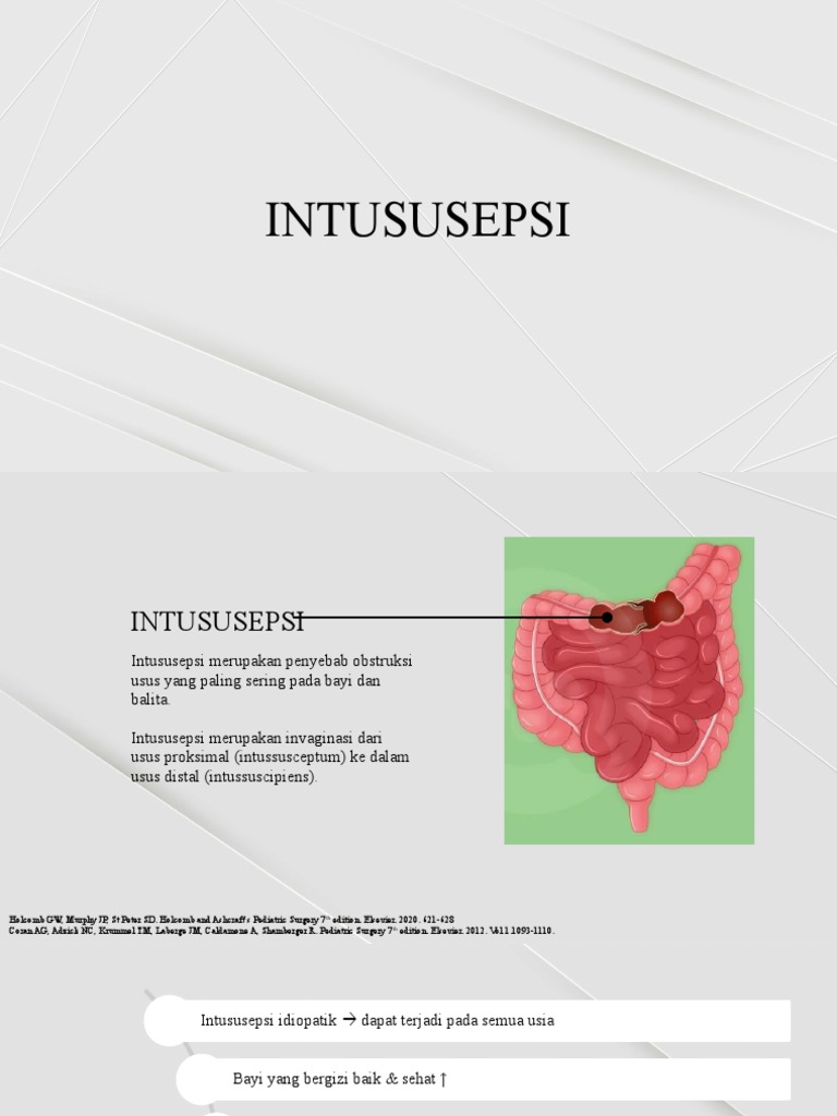 Intususepsi | PDF