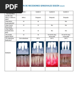 Clasificación de Seibert Los Defectos Del Reborde Alveolar | PDF