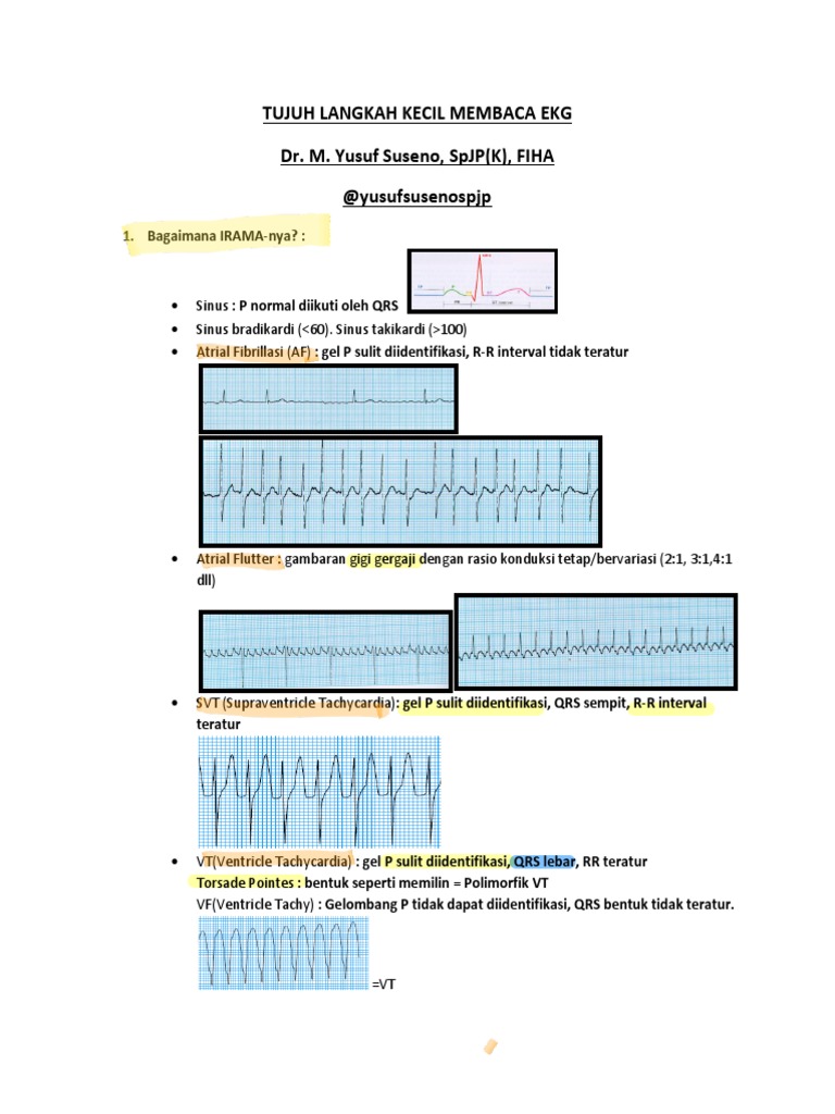 Cara Baca EKG | PDF