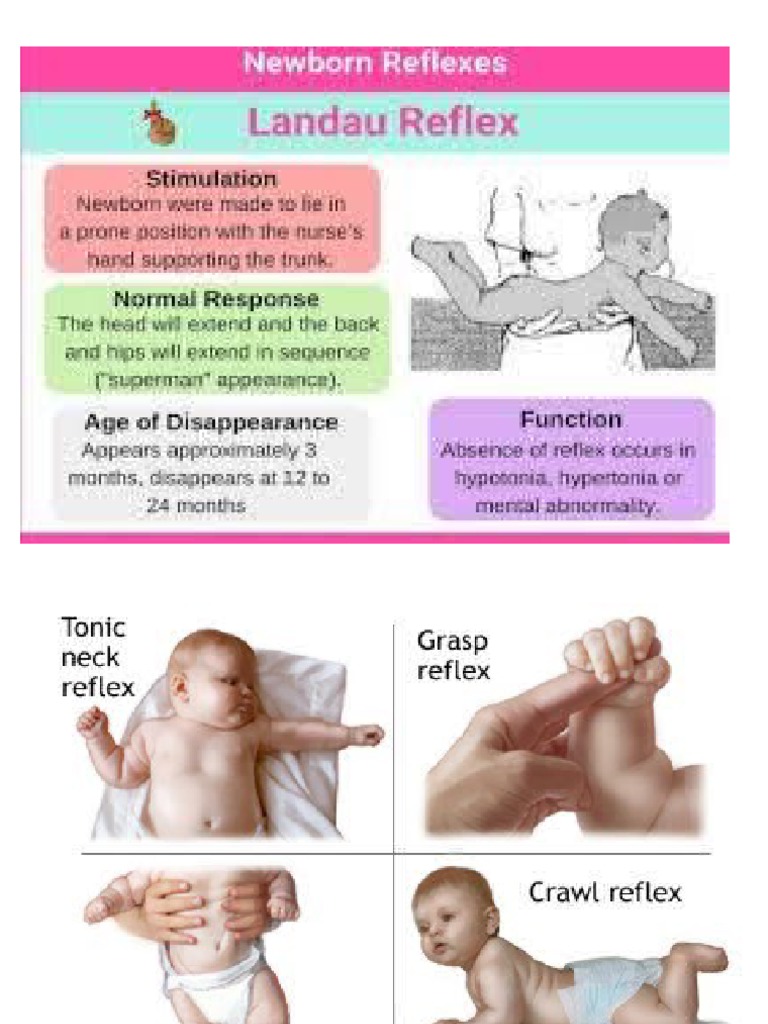 New Born Reflexes | PDF