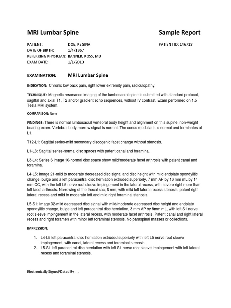 Mri Lumbar Spine Sample Report | PDF