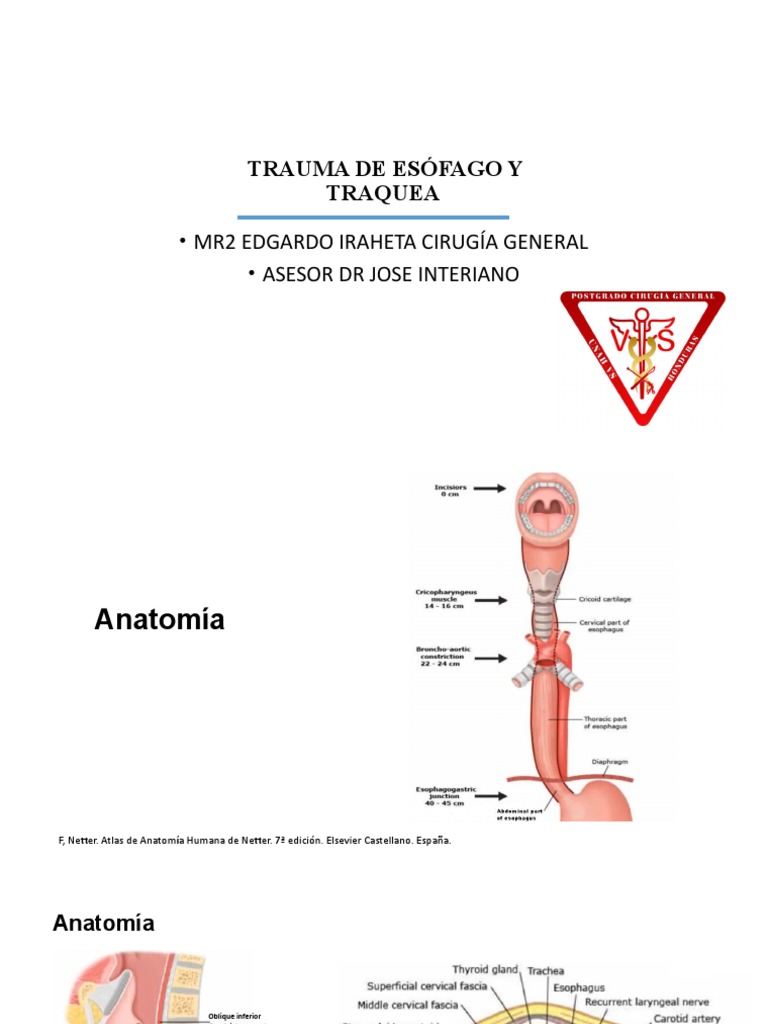 TRAUMA DE ESÓFAGO Y TRAQUEA Iraheta | PDF | Especialidades Medicas ...