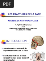 Anatomie et Fractures du Rocher | PDF | Tête et cou chez l'humain ...