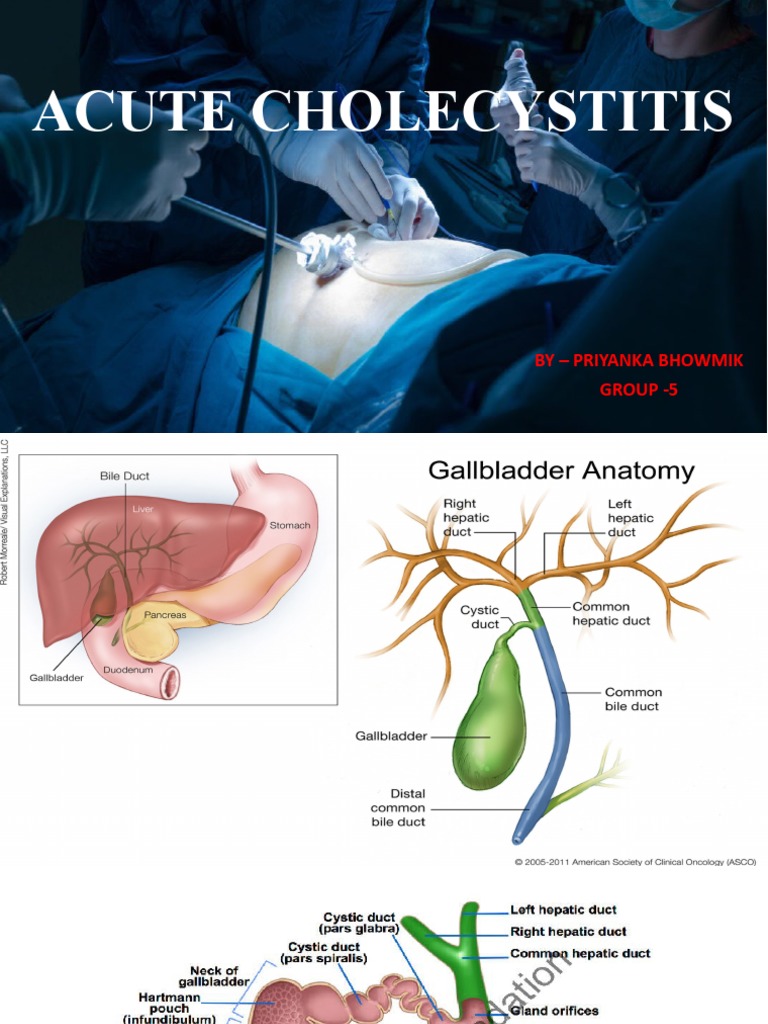 Acute Cholecystitis: by - Priyanka Bhowmik Group - 5 | PDF