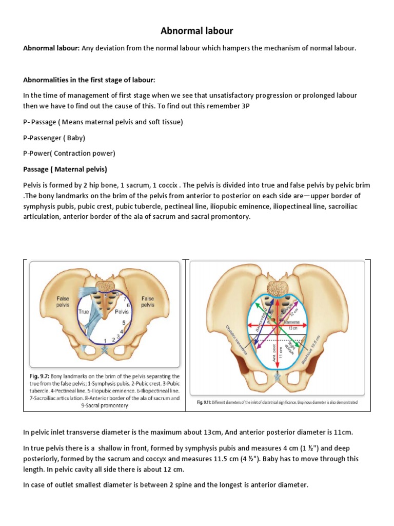 Abnormal Labour | PDF | Pelvis | Childbirth