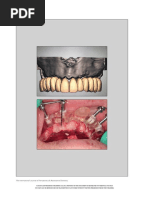 Philippine Laws of PWD Infographic | PDF | Disability | Accessibility