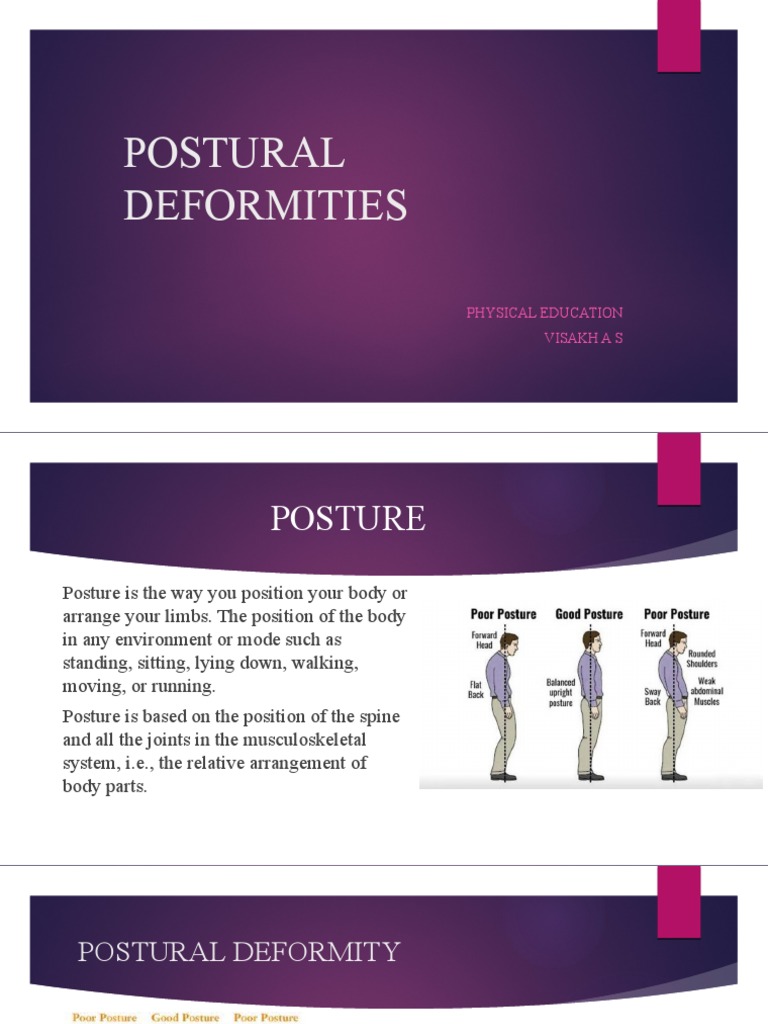 Postural Deformities: Physical Education Visakh A S | PDF | Self ...