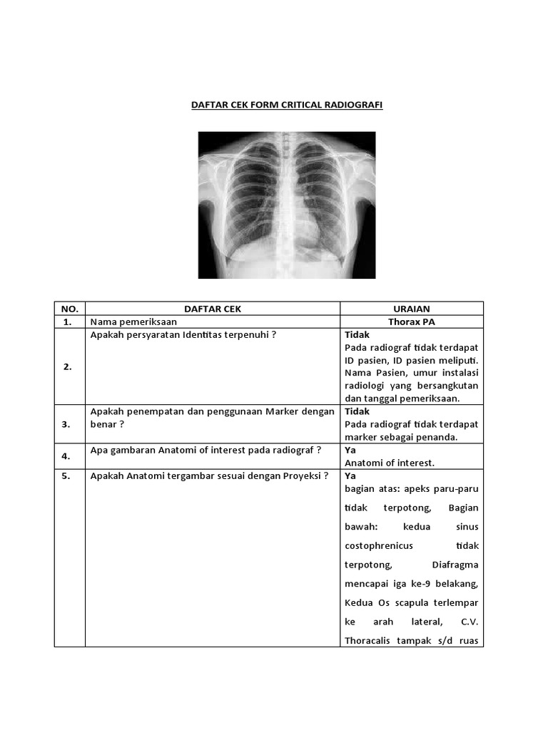 Daftar Cek Form Critical Radiografi | PDF