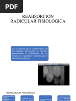 Rizolisis Dental 2 | PDF | Hueso | Inflamación