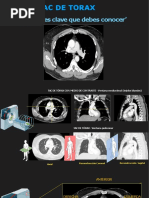 Clasificación de Keros | PDF