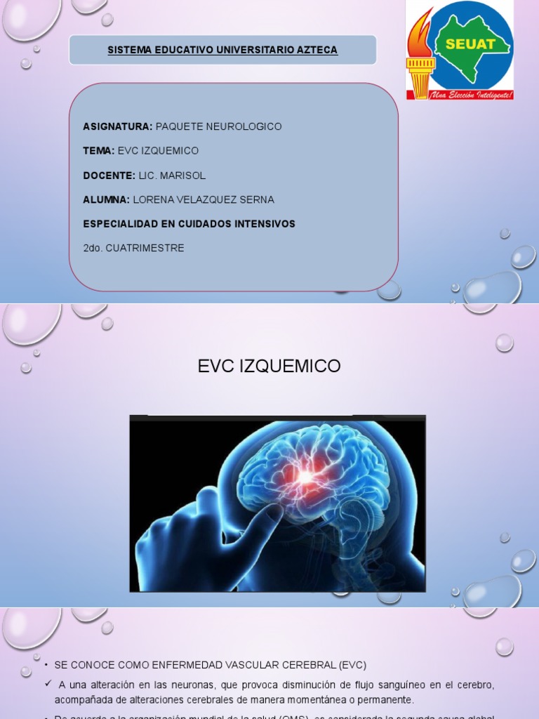 Evc Isquemico. Exposicion | PDF | Carrera | Isquemia