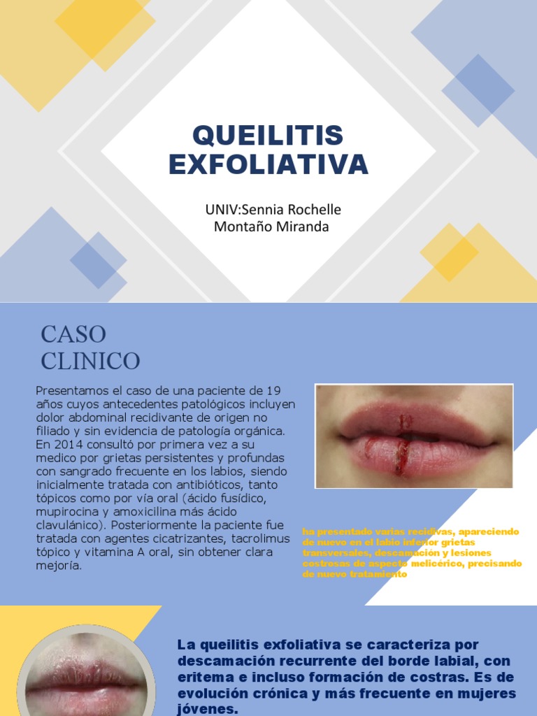 Queilitis Exfoliativa | PDF | Medicina CLINICA | Especialidades Medicas