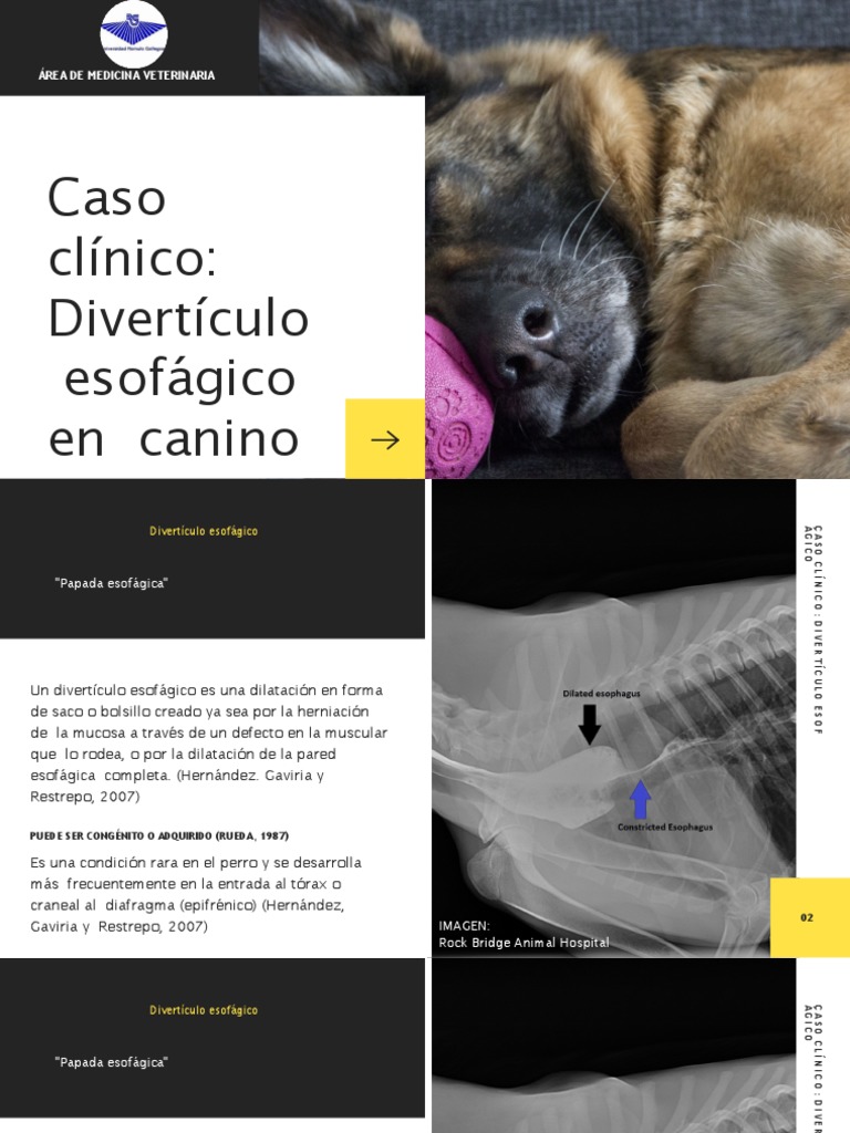 Caso Clínico de Diverticulo Esofágico | PDF | Cirugía | Enfermedades y ...