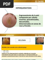 Onicofosis: Causas y Tratamiento | PDF