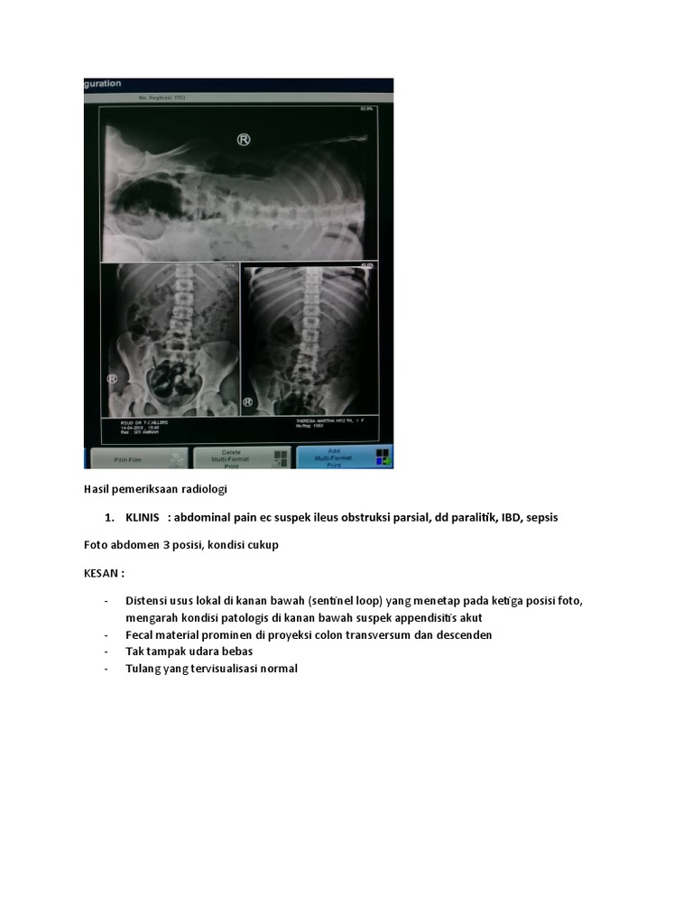 Hasil Pemeriksaan Radiologi Ujian | PDF | Sains & Matematika