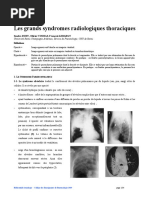 Sémiologie radiologique du syndrome bronchique | PDF | Poumon ...