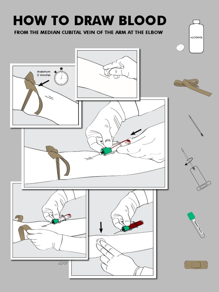 How To Draw Blood: From The Median Cubital Vein of The Arm at The Elbow ...