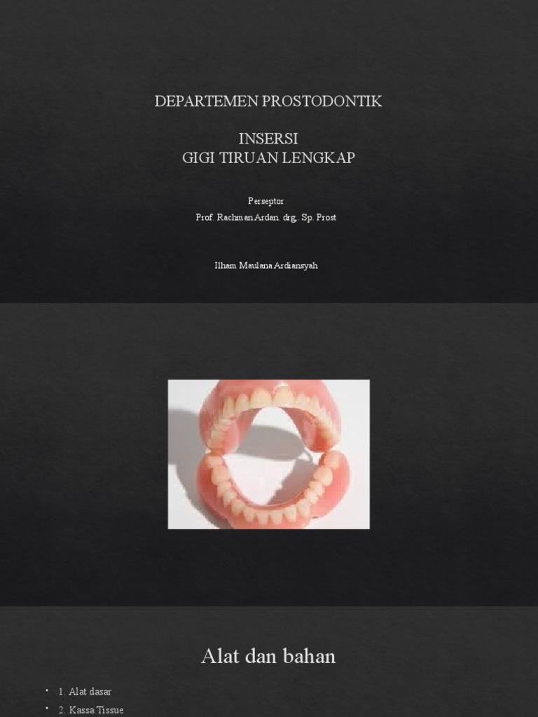 Insersi GTL - Ilham | PDF