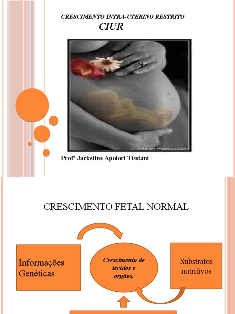 1.CIUR-Crescimento Intrauterino Restrito (Slides) | PDF | Gravidez ...