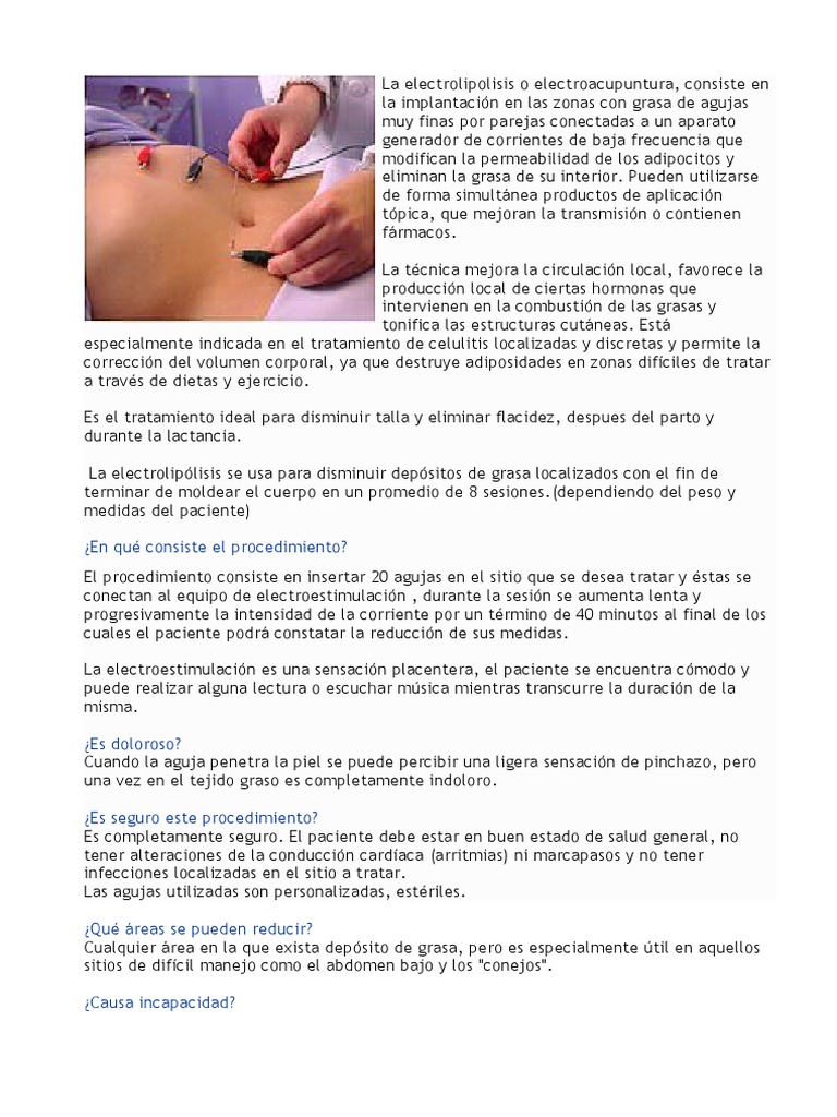 La Electrolipolisis o Electroacupuntura CON IMAGEN CAIMANES | PDF ...