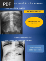 Pupil Isokor dan Anisokor: Penjelasan | PDF