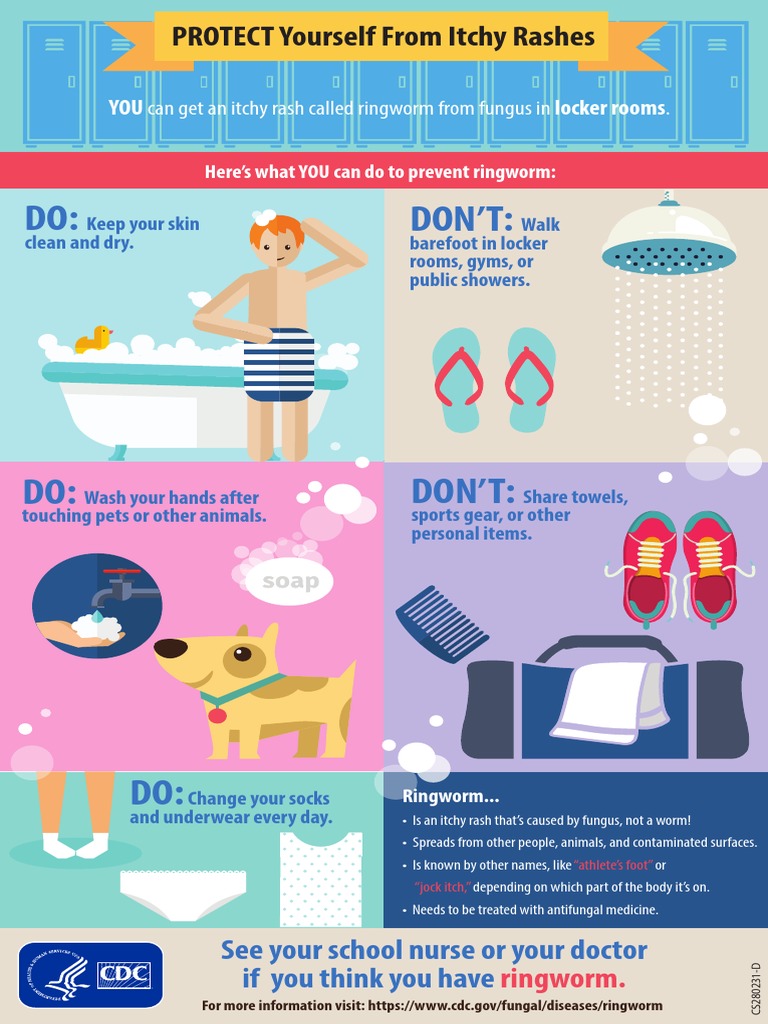 Ringworm Infographic | PDF