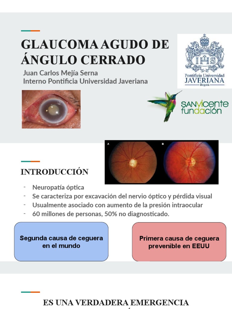 Glaucoma Agudo de Ángulo Cerrado | PDF | Glaucoma | Ojo humano