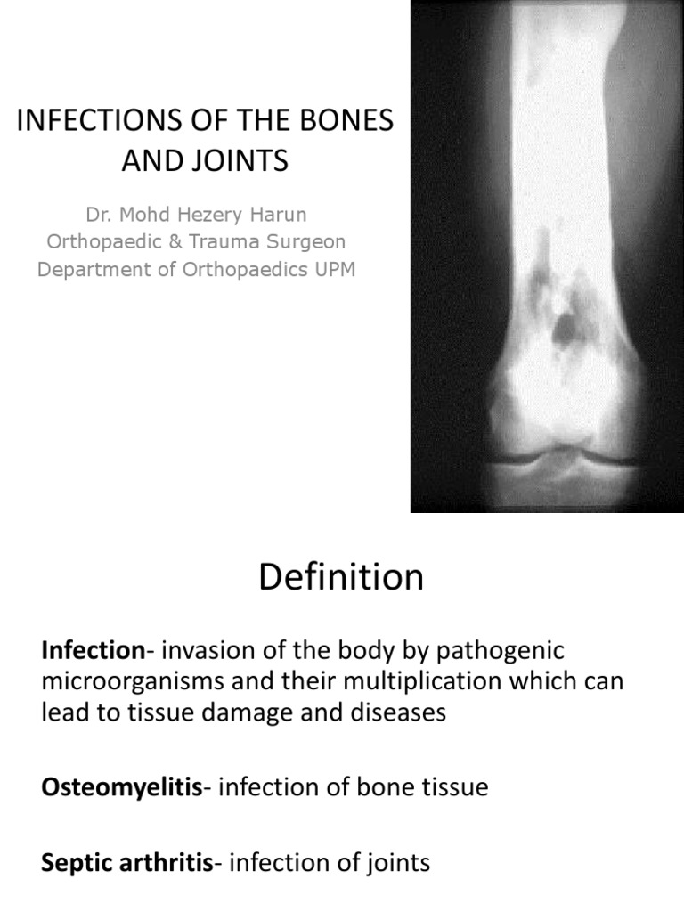 Osteomyelitis and Septic Arthritis Overview | PDF | Staphylococcus ...