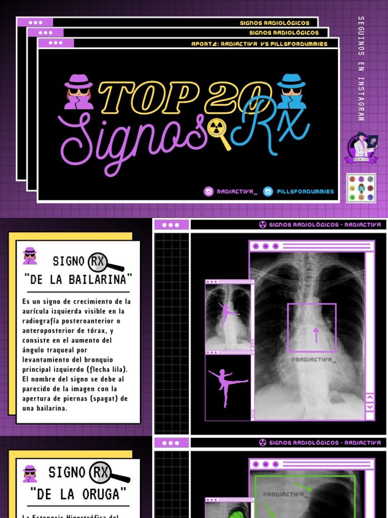 Top 20 Signos Radiológicos | PDF | Hueso | Cáncer colonrectal