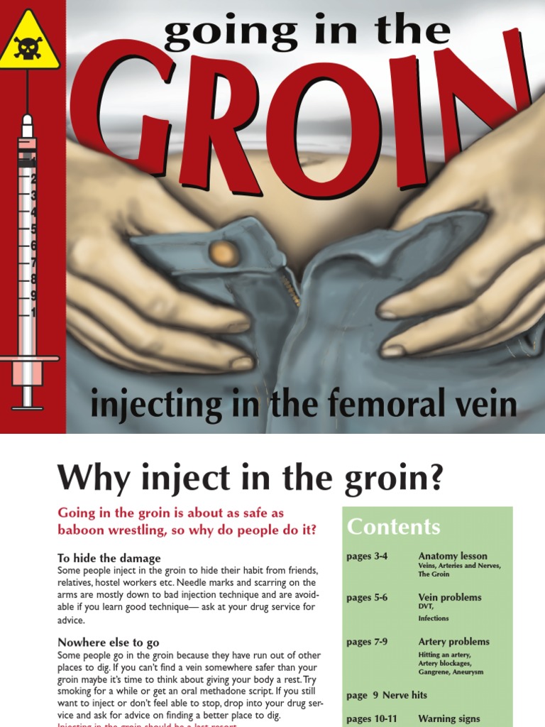 IMO6 - Going in Groin | PDF | Vein | Artery