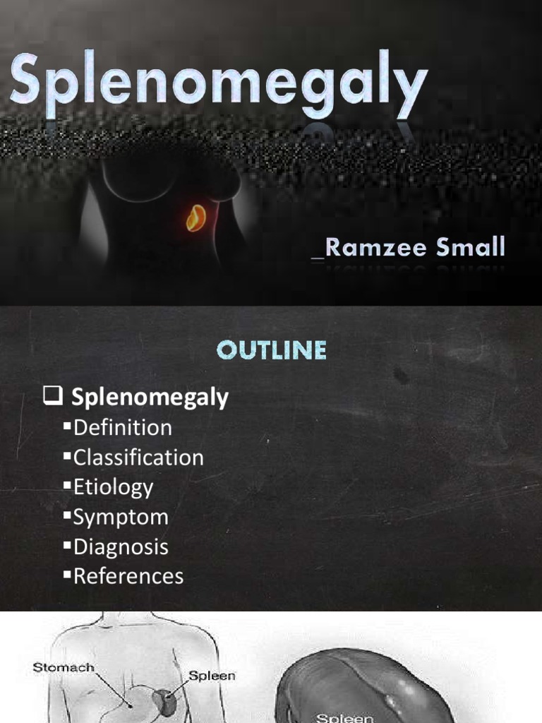 Understanding Mild Splenomegaly | PDF | Spleen | Anatomy
