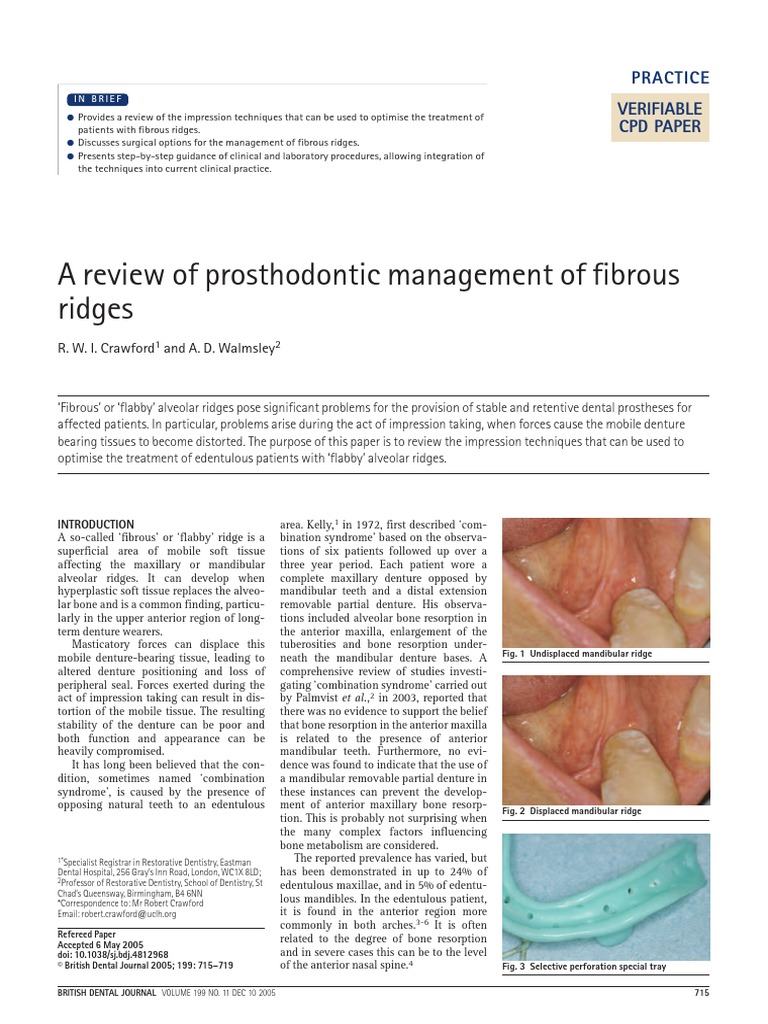 A Review of Prosthodontic Management of Fibrous Ridges: Practice | PDF ...